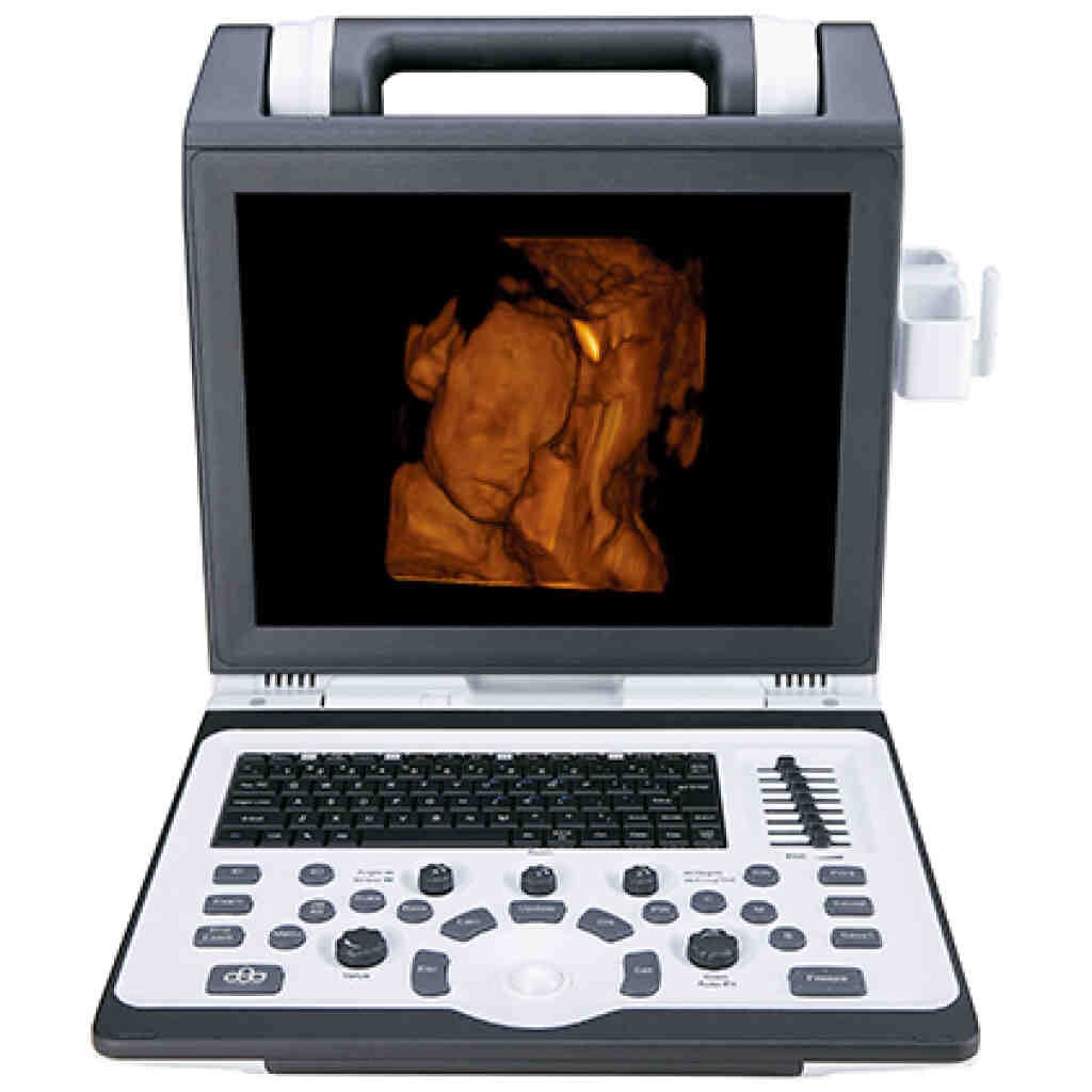 Doppler vascular Sonoline C Pocket - Promed