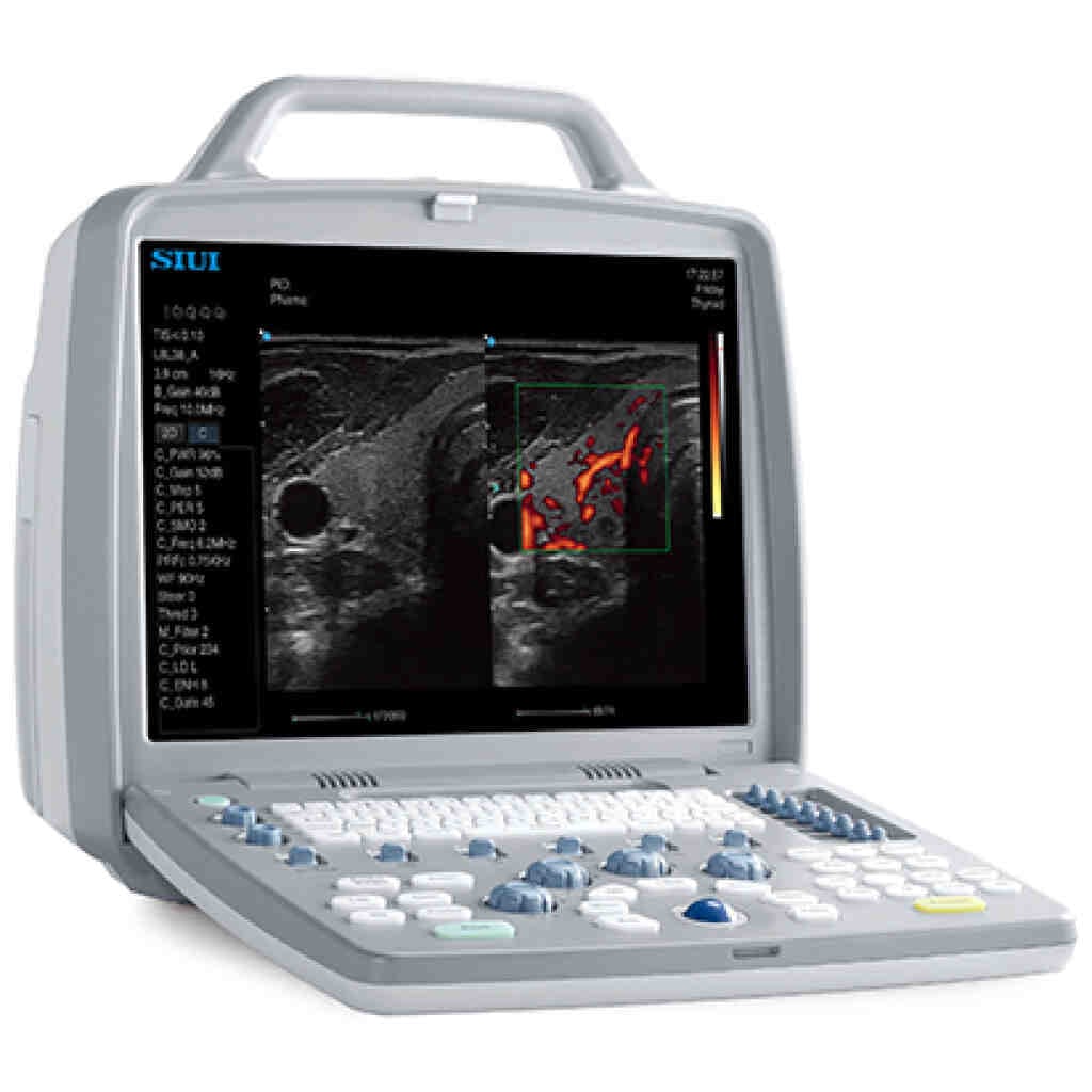Doppler vascular Sonoline C Pocket - Promed